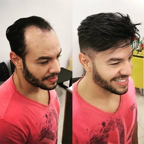 A Complete Guide About Toupees