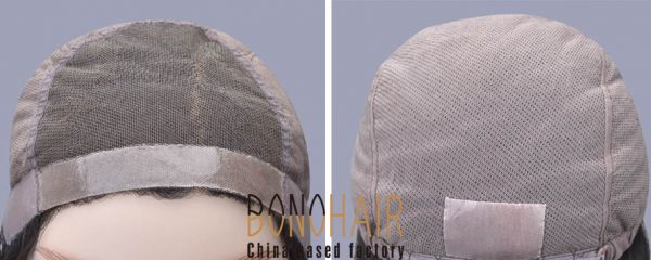 Basic Guide Of Cranial Prosthesis Aka Medical Wigs