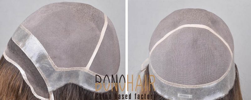 Basic Guide Of Cranial Prosthesis Aka Medical Wigs
