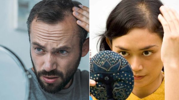 ¿Cuál es el mejor tratamiento para la caída del cabello para usted?