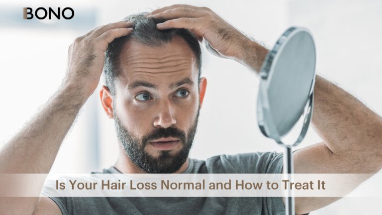 Is Your Hair Loss Normal and How to Treat It