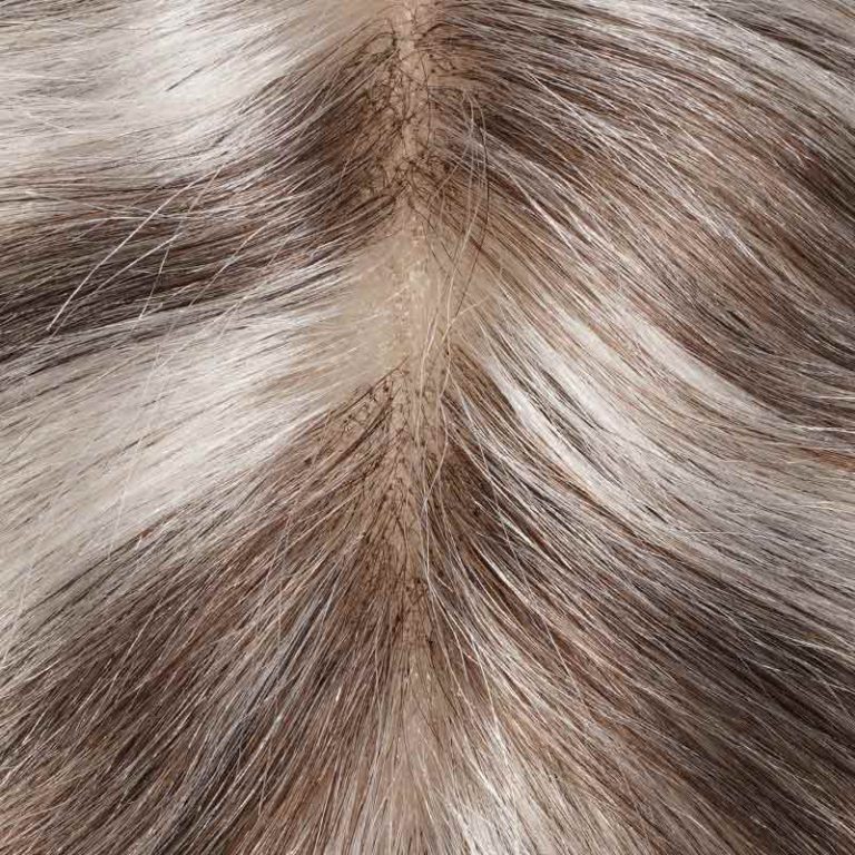 Stripe Color Hair System | Invisible Lace Hair Systems | Bono Hair