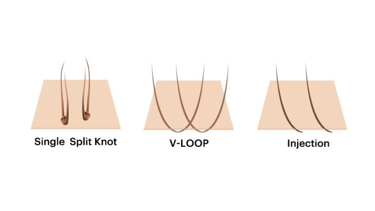 How to customize a hair system with a long life span? | Bono Hair