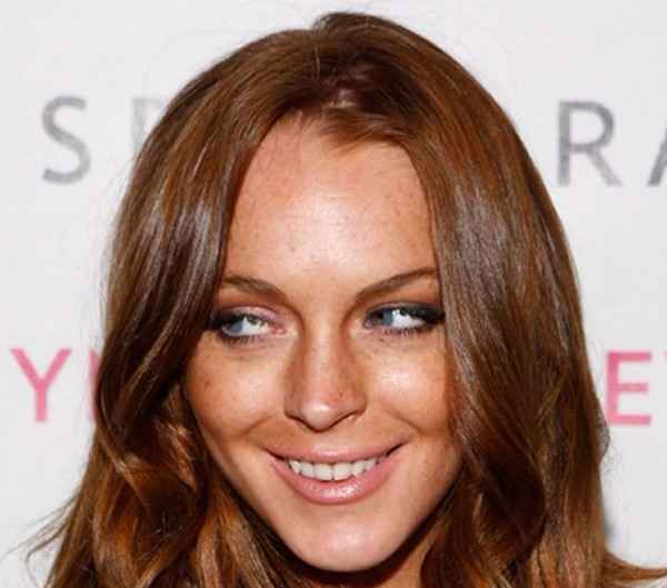 Is Your Hairline Receding? Know the Types and How to Act