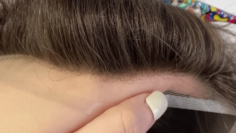 Secret to Creating the Most Natural Hairline for Men’s Hair Systems